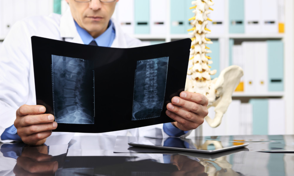 NHS Never Events 2024/25: Data, Impact, and What It Means for Patient ...